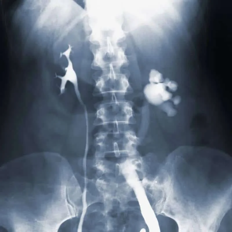 Examen de radiografía columna lumbar